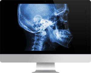 i-CAT | Innovative Orthodontic Centers