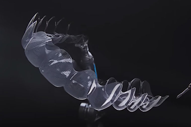 What is Invisalign? | Innovative Orthodontic Centers