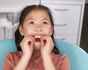 Invisalign Palatal Expander - Innovative Orthodontic Centers